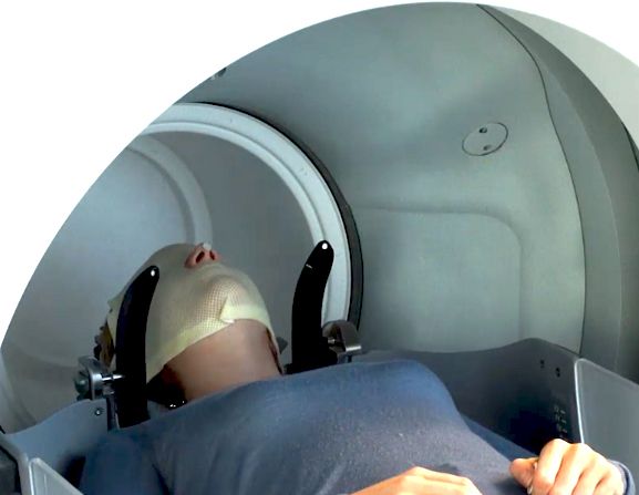 Mask/Frame based treatments - Nova Healthcare