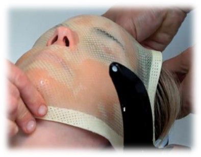 Mask/Frame based treatments - Nova Healthcare